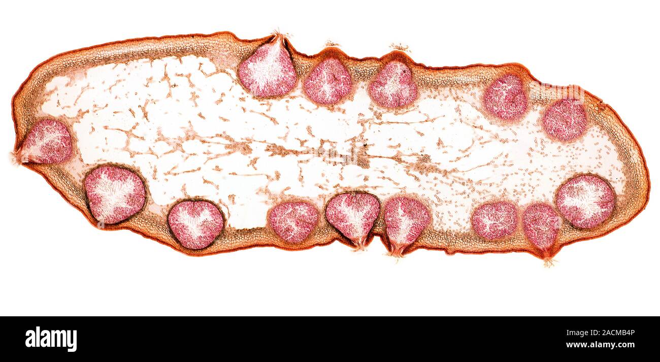 Male bladder wrack. Light micrograph of a section through a male of the ...