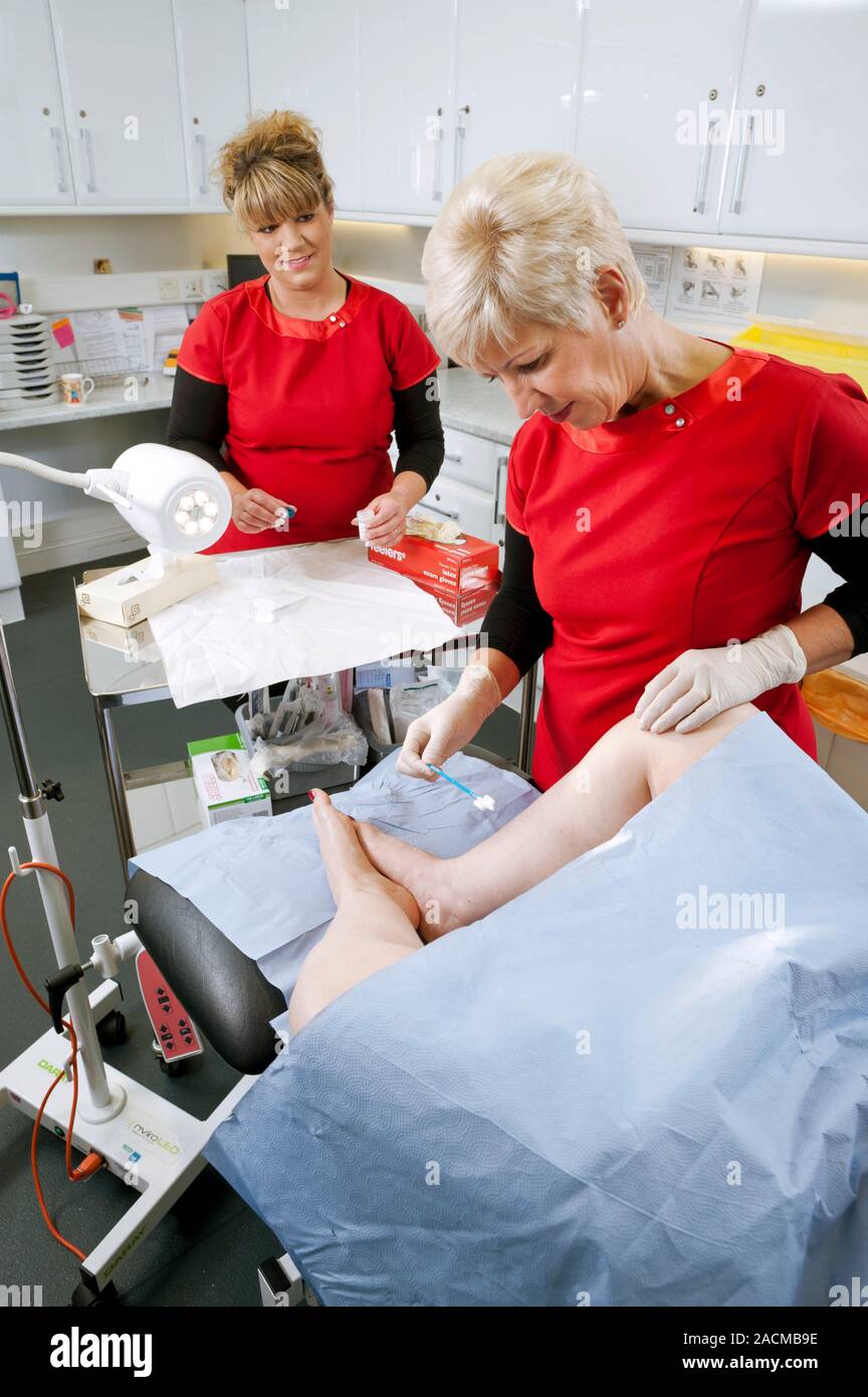 Smear test. Practice nurses performing a smear test on a patient. A ...