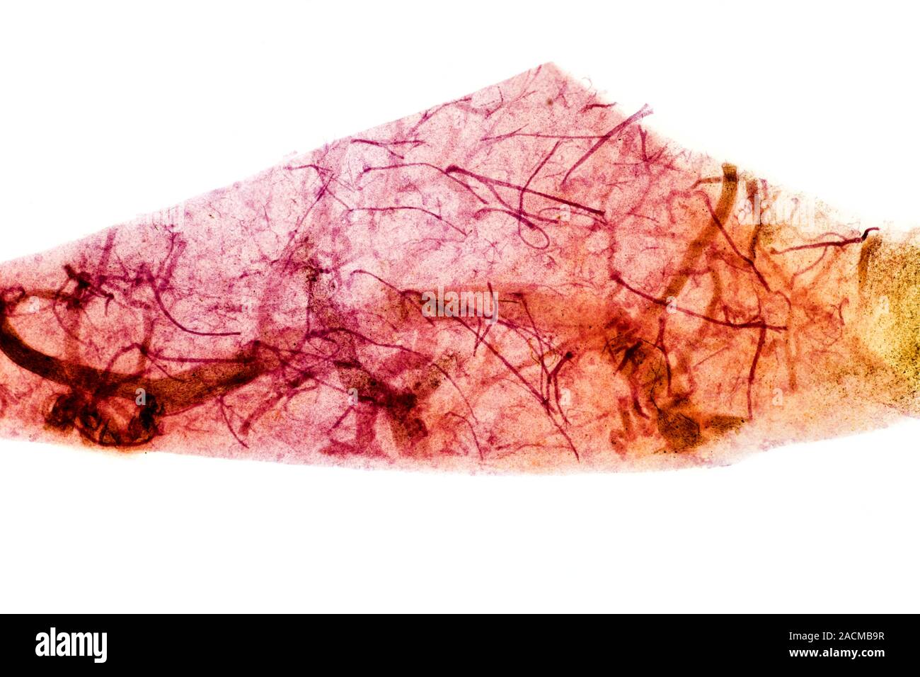 Brain membrane. Light micrograph of the pia mater, the inner layer of ...