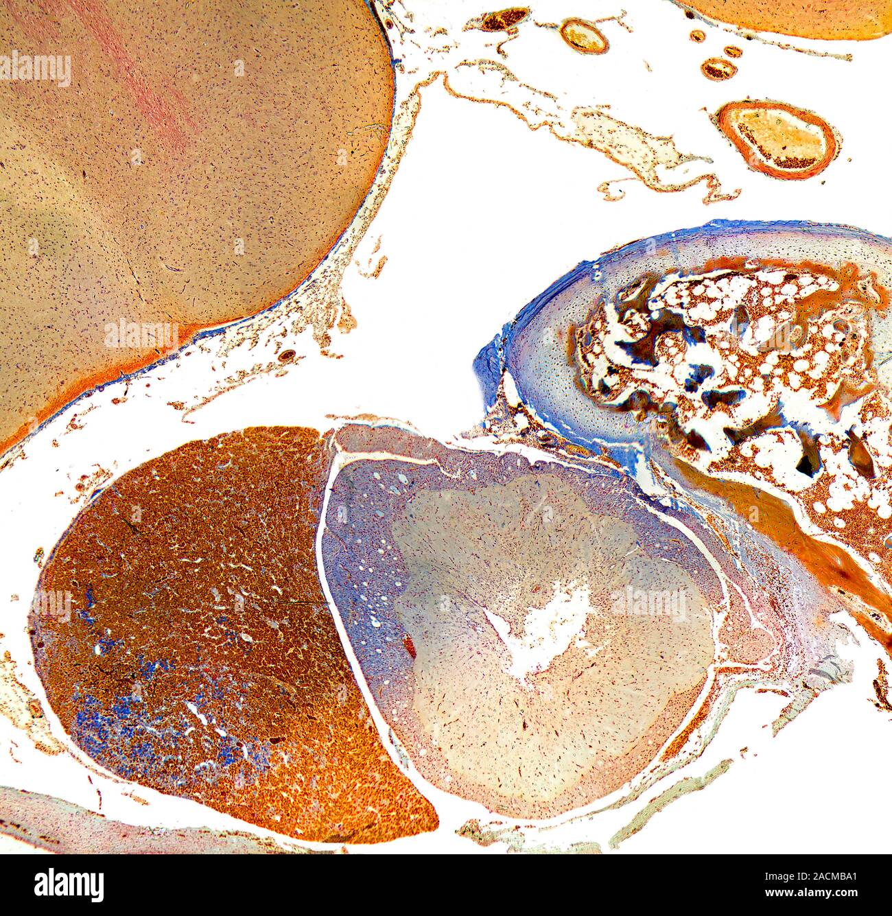Pituitary gland. Light micrograph of a section through the brain ...