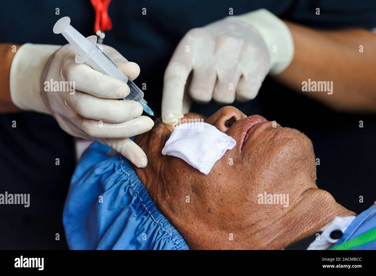 Eye clinic. Patient being given a local anaesthetic prior to undergoing ...