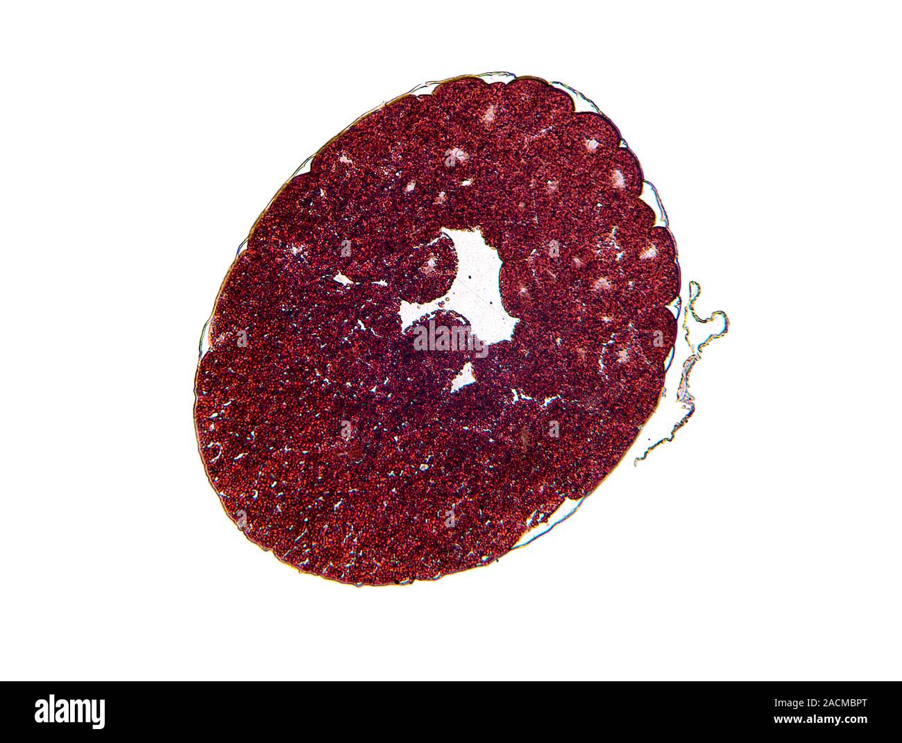 Frog embryo, morula stage, light micrograph. This is an embryo of a ...