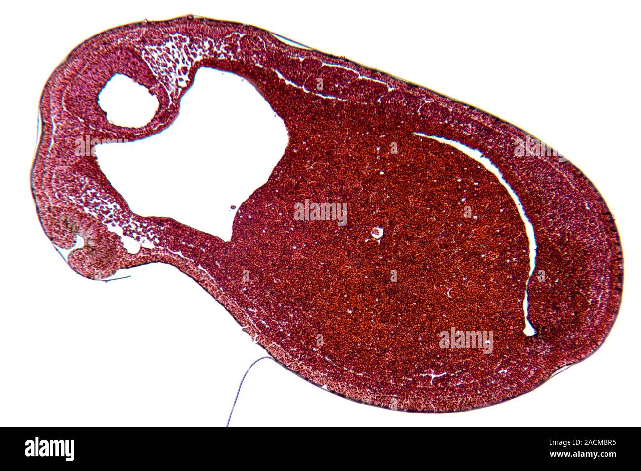 Frog embryo, tail bud stage, light micrograph. This is an embryo of a ...