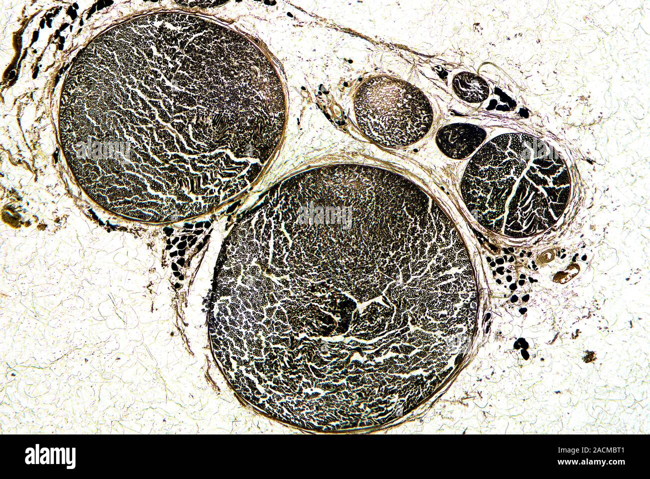 Nerve bundles. Light micrograph of a section through bundles (large ...