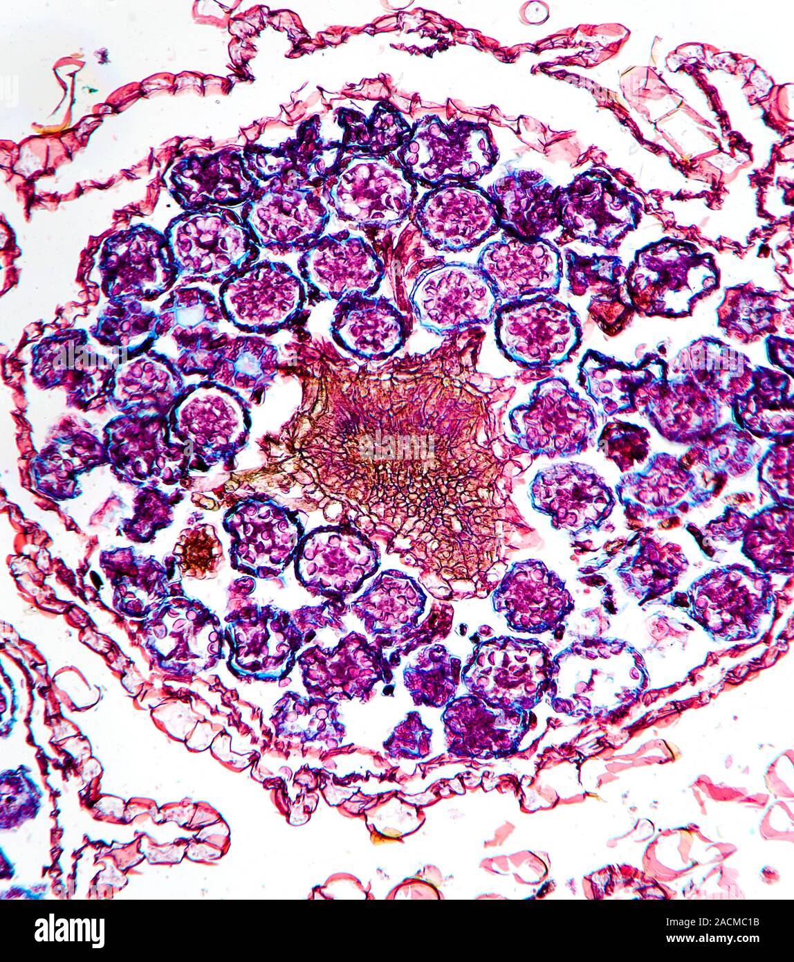 Water fern spores. Light micrograph of a transverse section through a ...