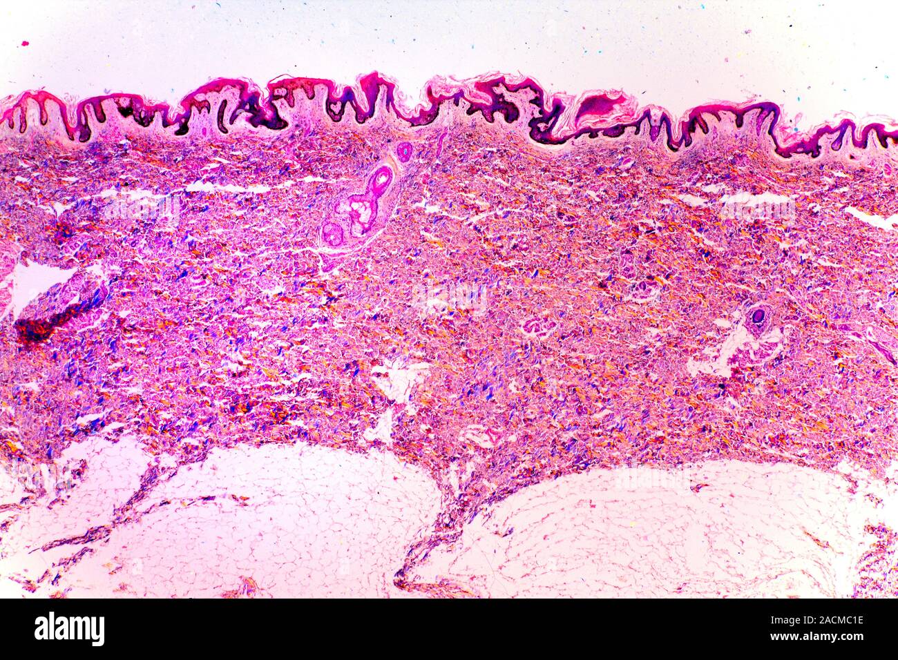 Skin. Light micrograph of a section through skin. At top is the ...
