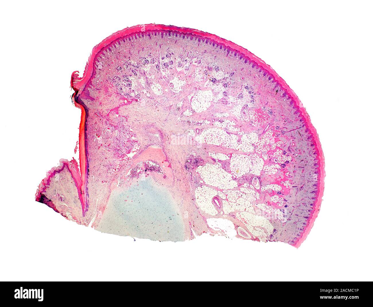 Fingertip skin. Light micrograph of a section through the skin of the ...