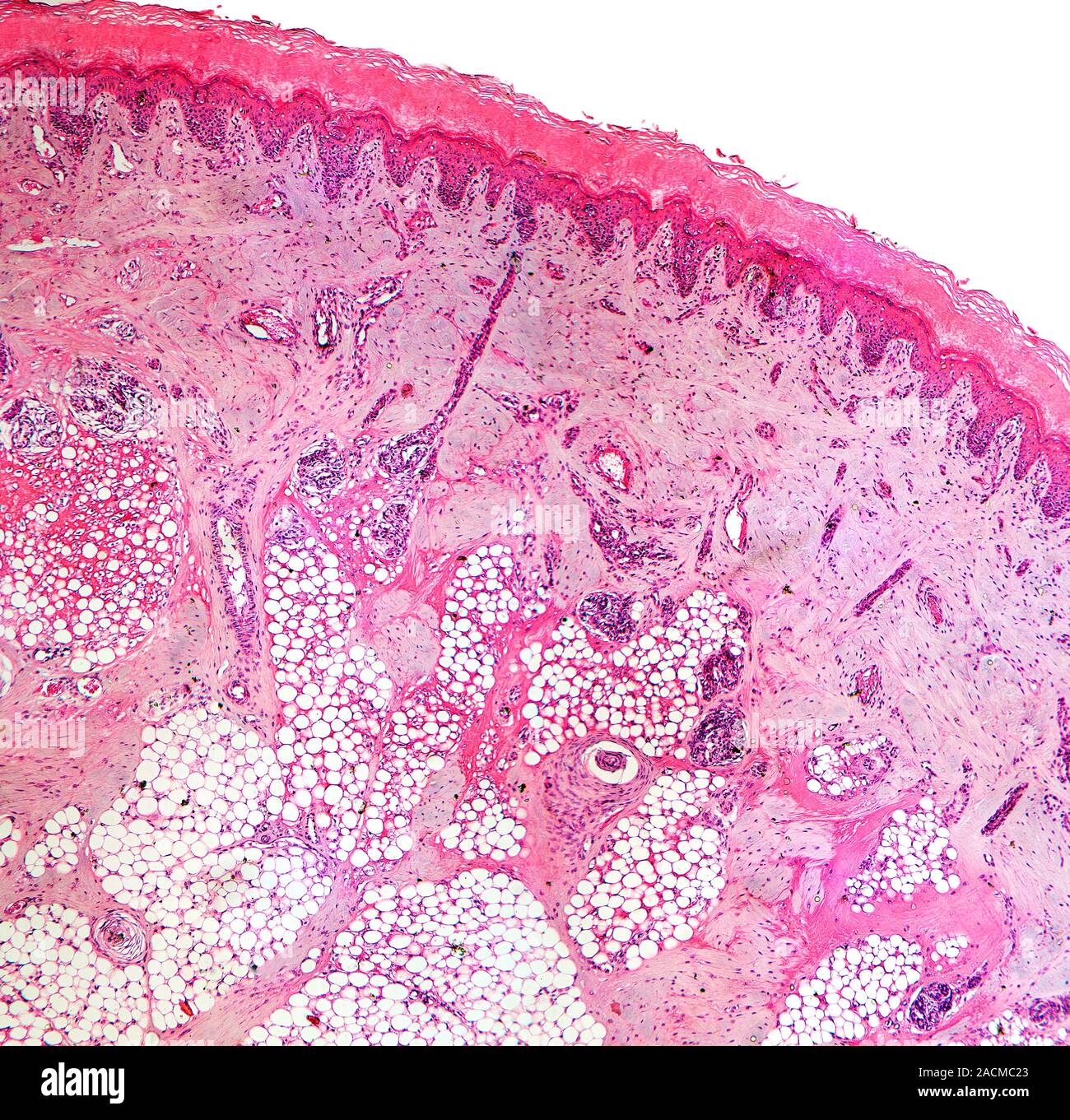 Fingertip skin. Light micrograph of a section through the skin of the ...