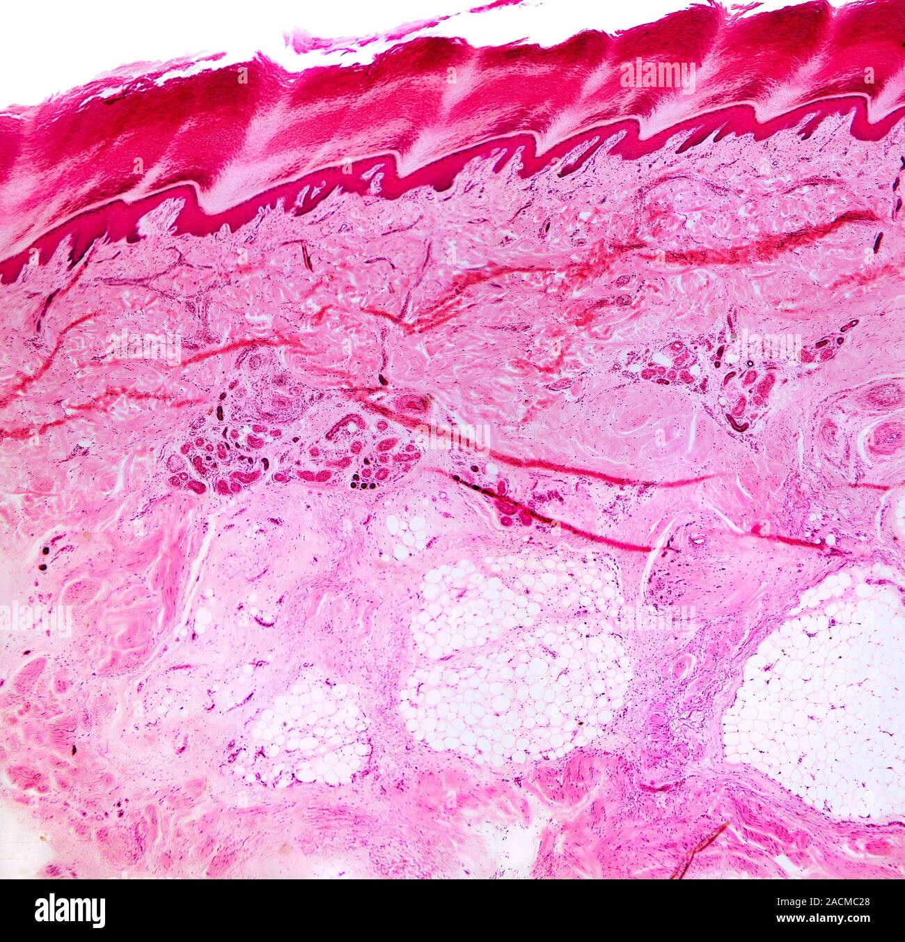 Skin section, light micrograph. The outer most layer of skin is the ...