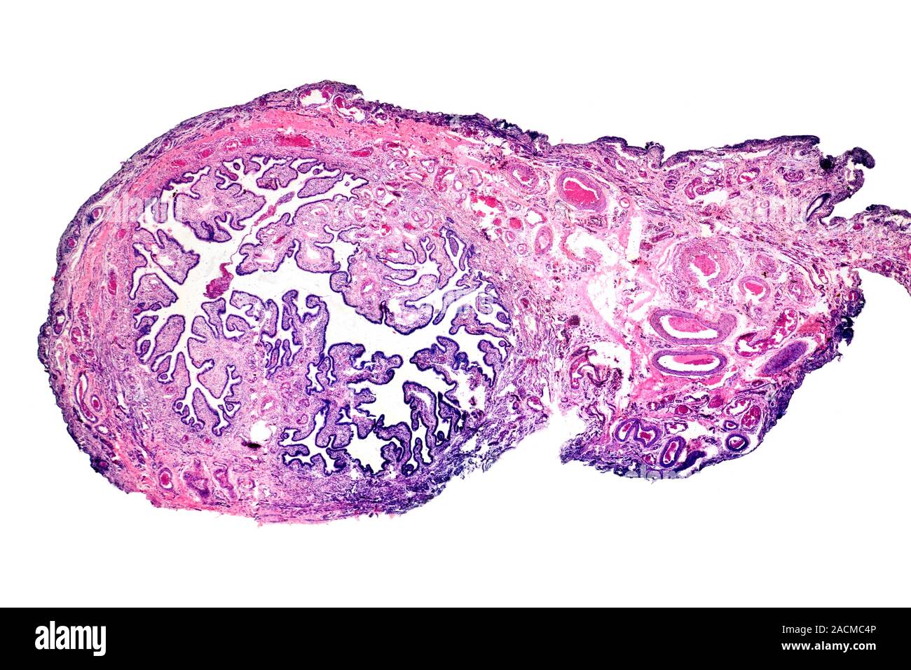 Fallopian tube. Light micrograph of a section through a fallopian tube ...