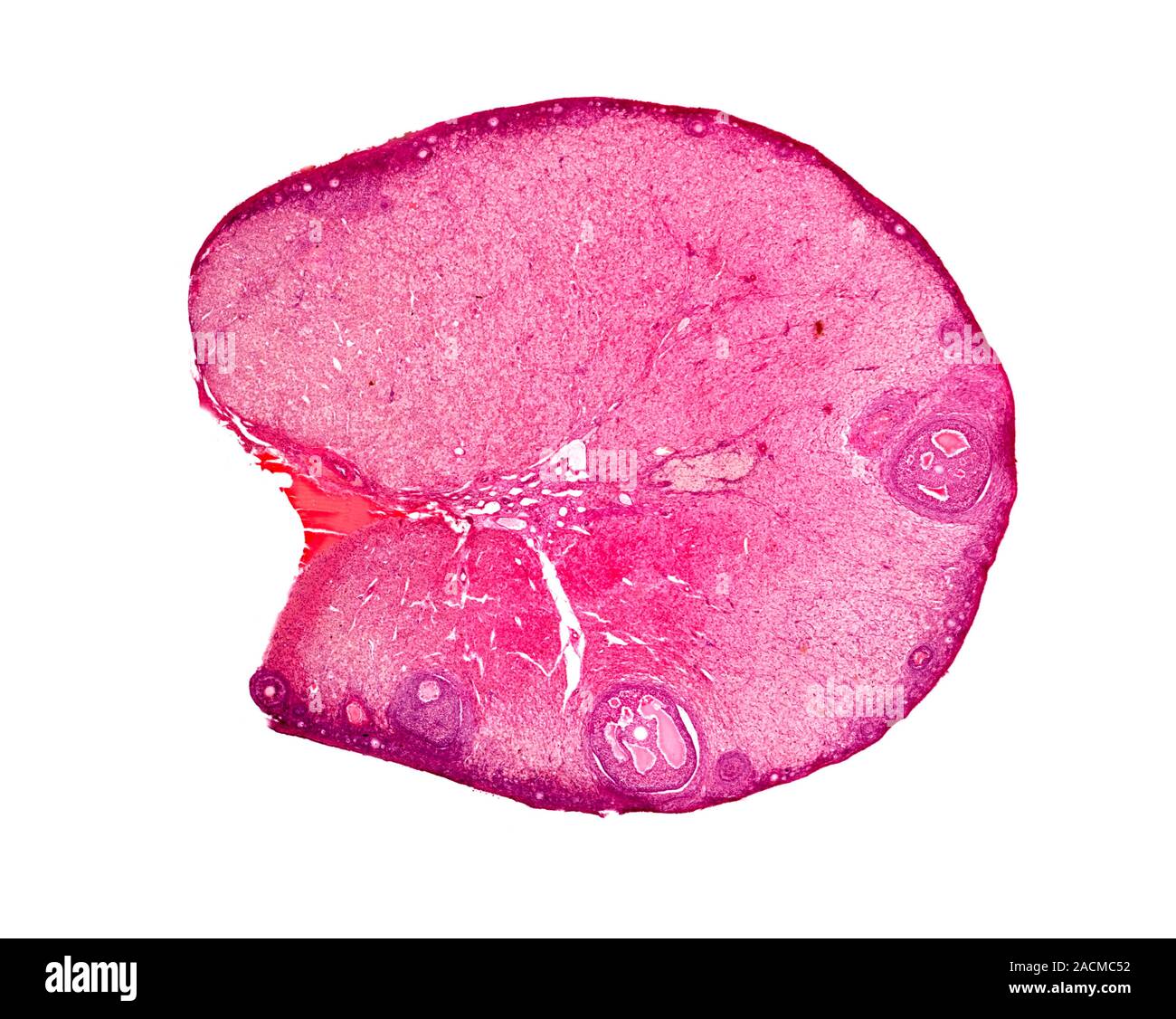 Ovary. Light micrograph of a section through an ovary showing follicles ...
