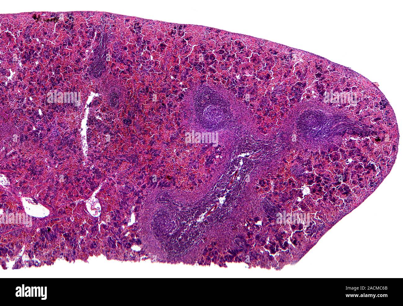 Spleen. Light micrograph of a section through the spleen. Situated on ...