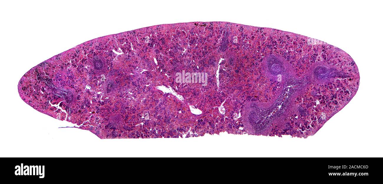 Spleen. Light micrograph of a section through the spleen. Situated on ...