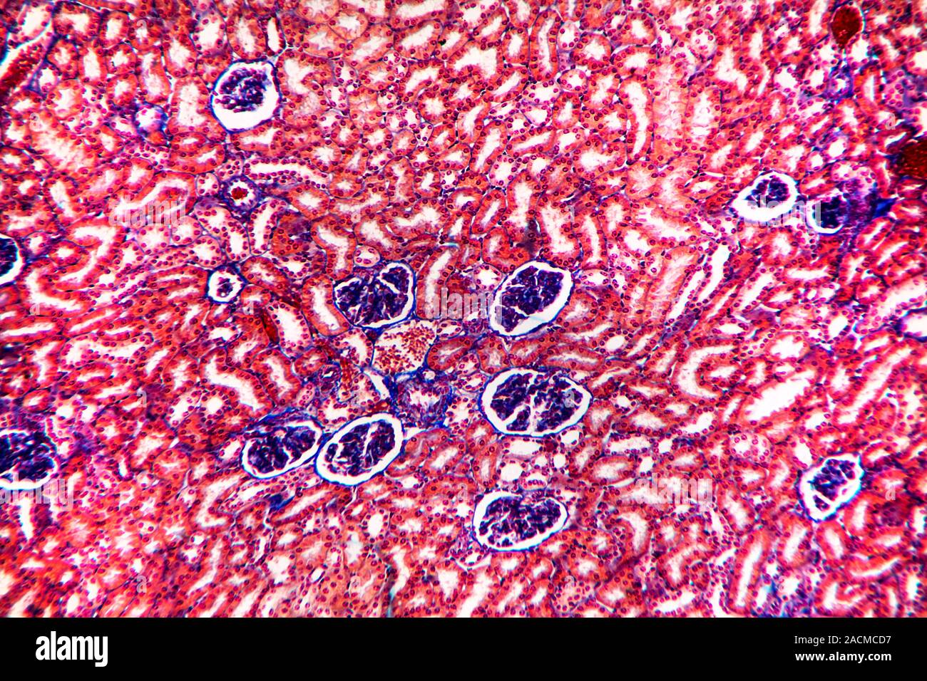 Kidney. Light micrograph of a section through the cortex of a kidney ...