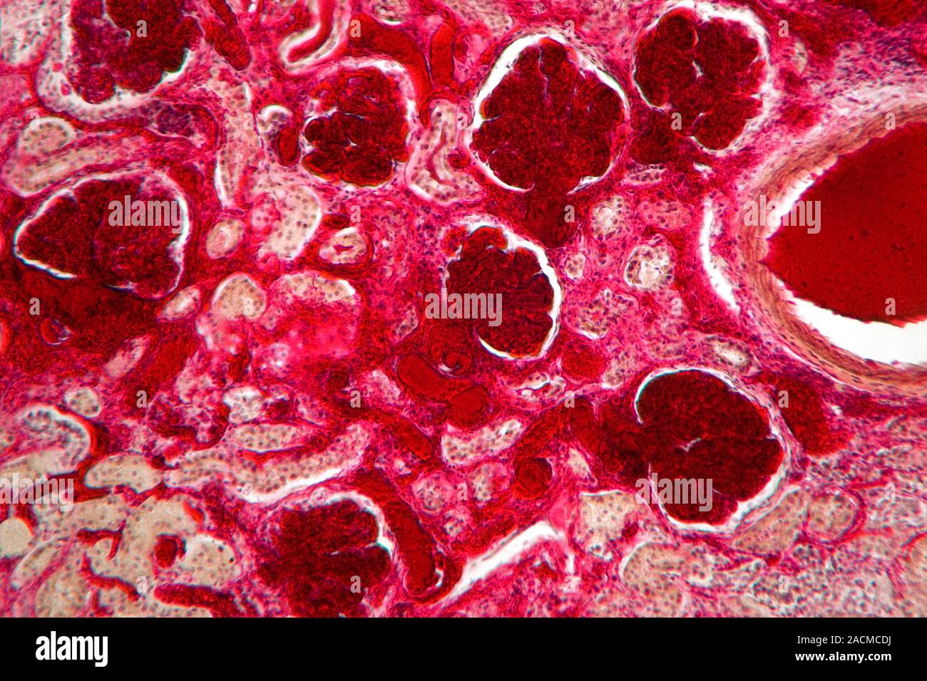 Kidney. Light micrograph of a section through the cortex of a child's ...