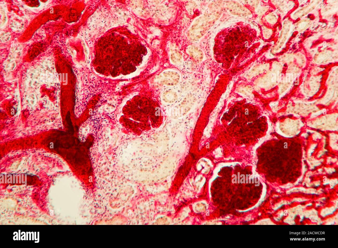 Kidney. Light micrograph of a section through the cortex of a child's ...