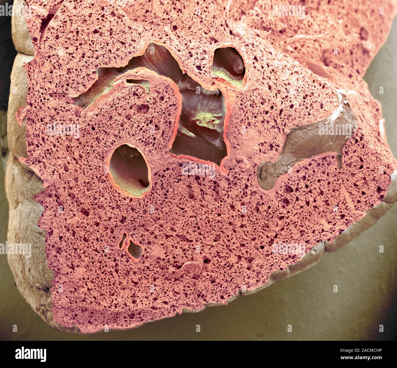 Lung tissue. Coloured scanning electron micrograph (SEM) of a section ...