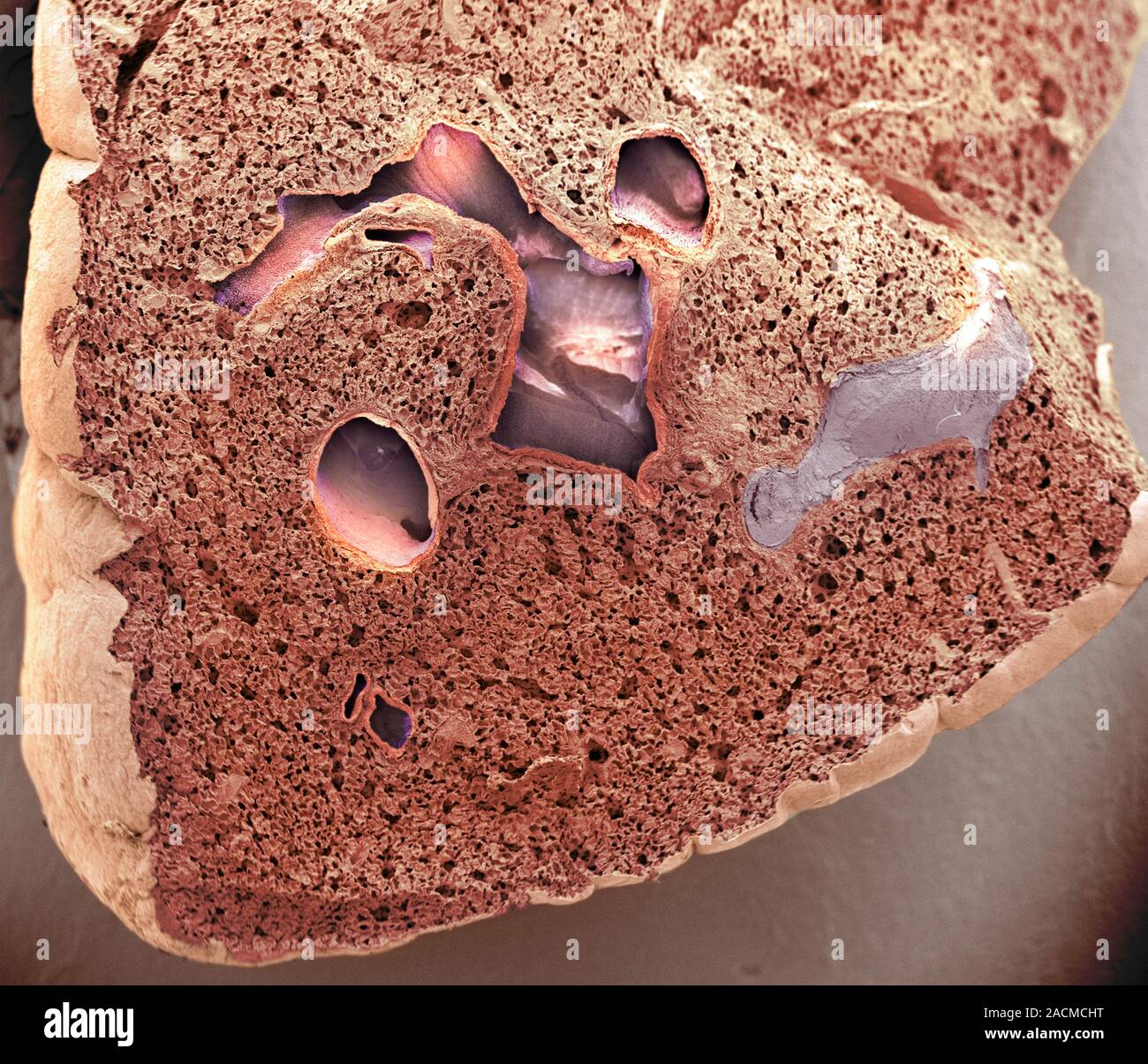 Lung tissue. Coloured scanning electron micrograph (SEM) of a section ...