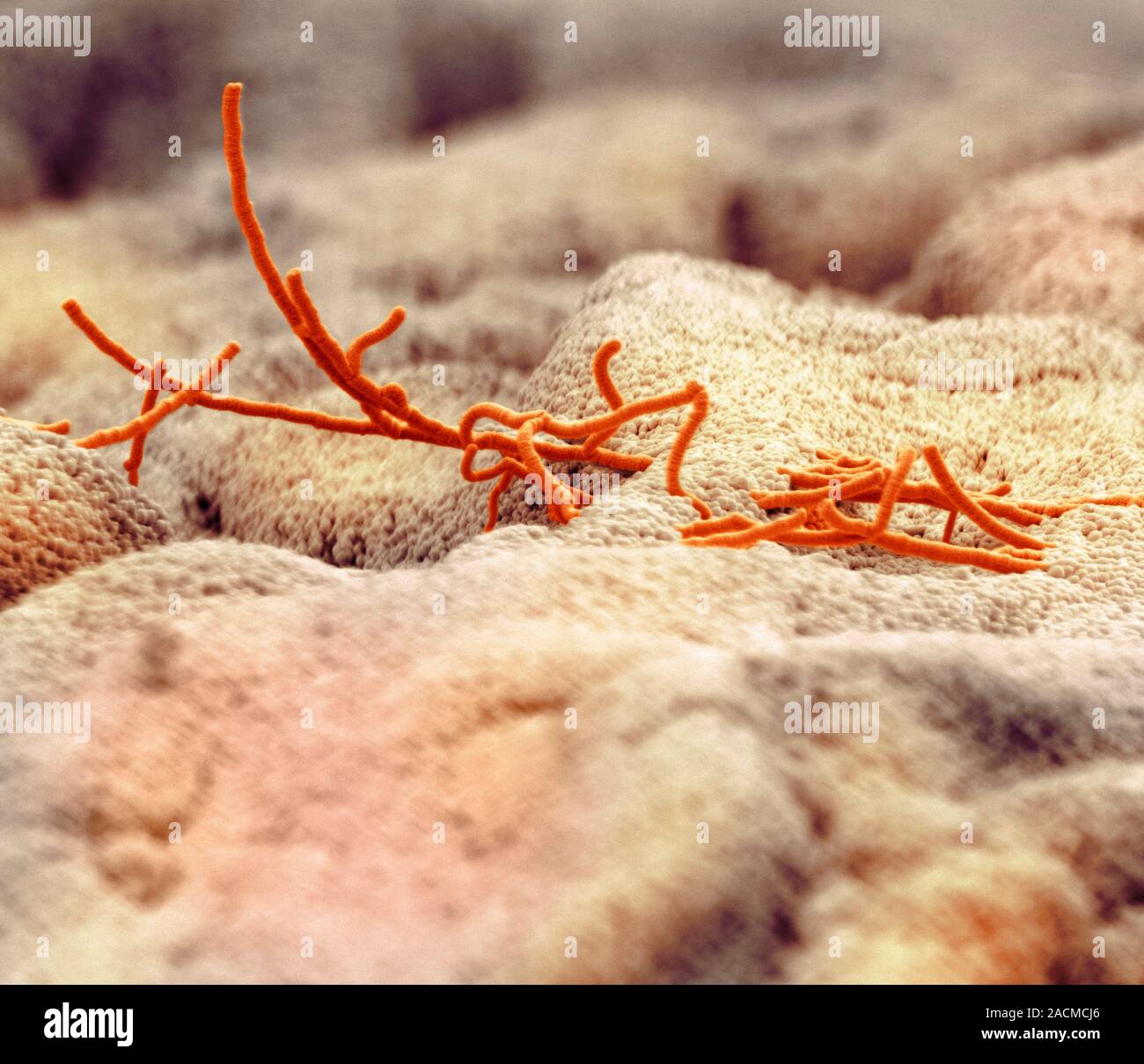 Parasites in large intestine. Coloured scanning electron micrograph ...