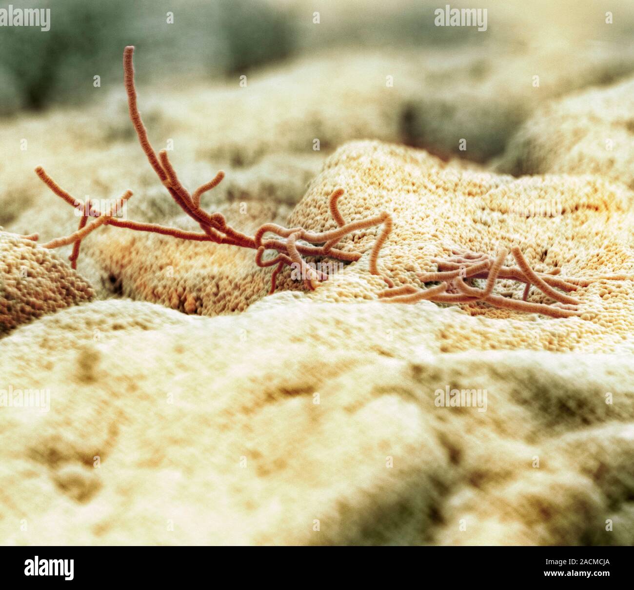 Parasites in large intestine. Coloured scanning electron micrograph ...