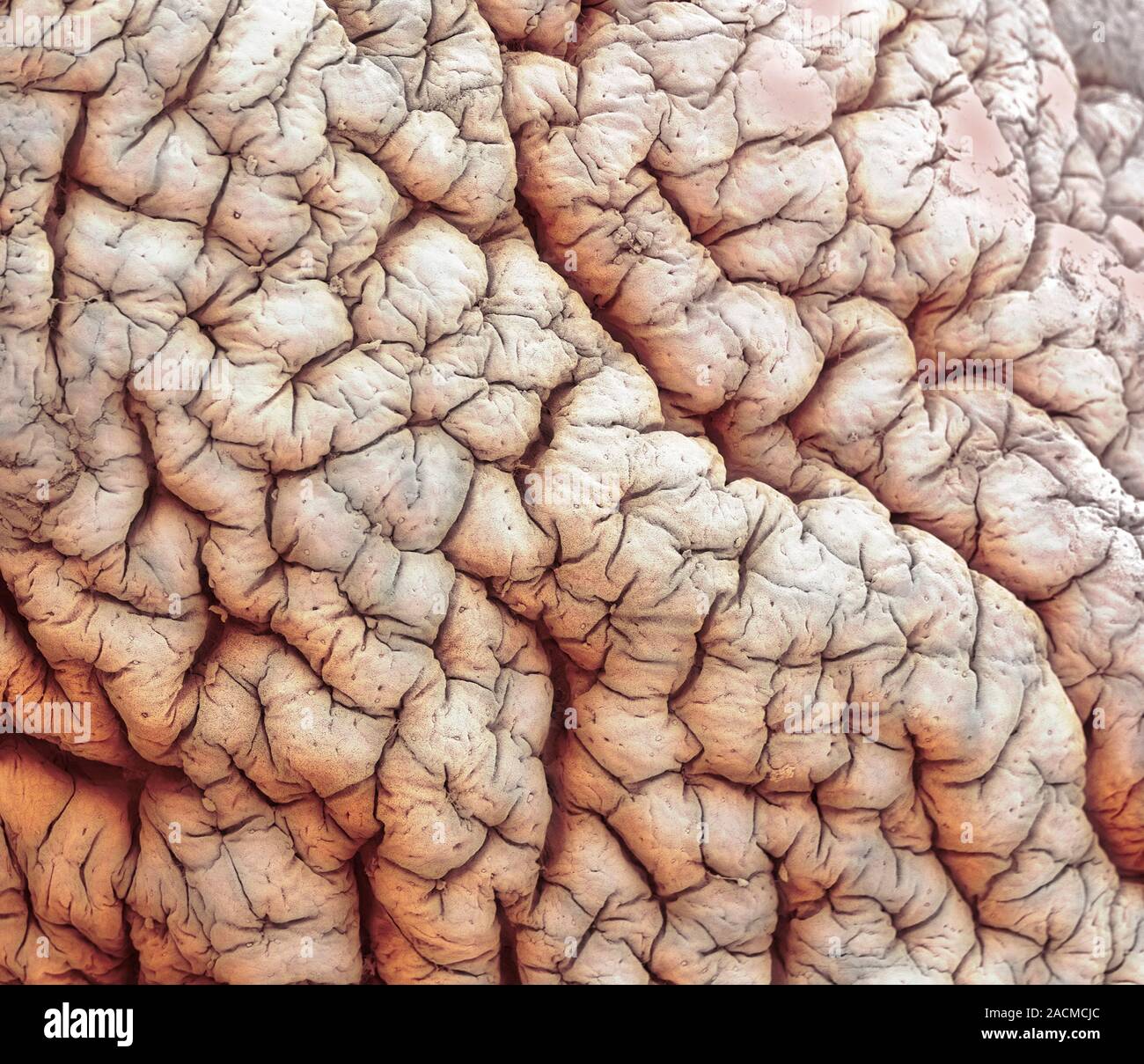 Large intestine. Coloured scanning electron micrograph (SEM) of the ...