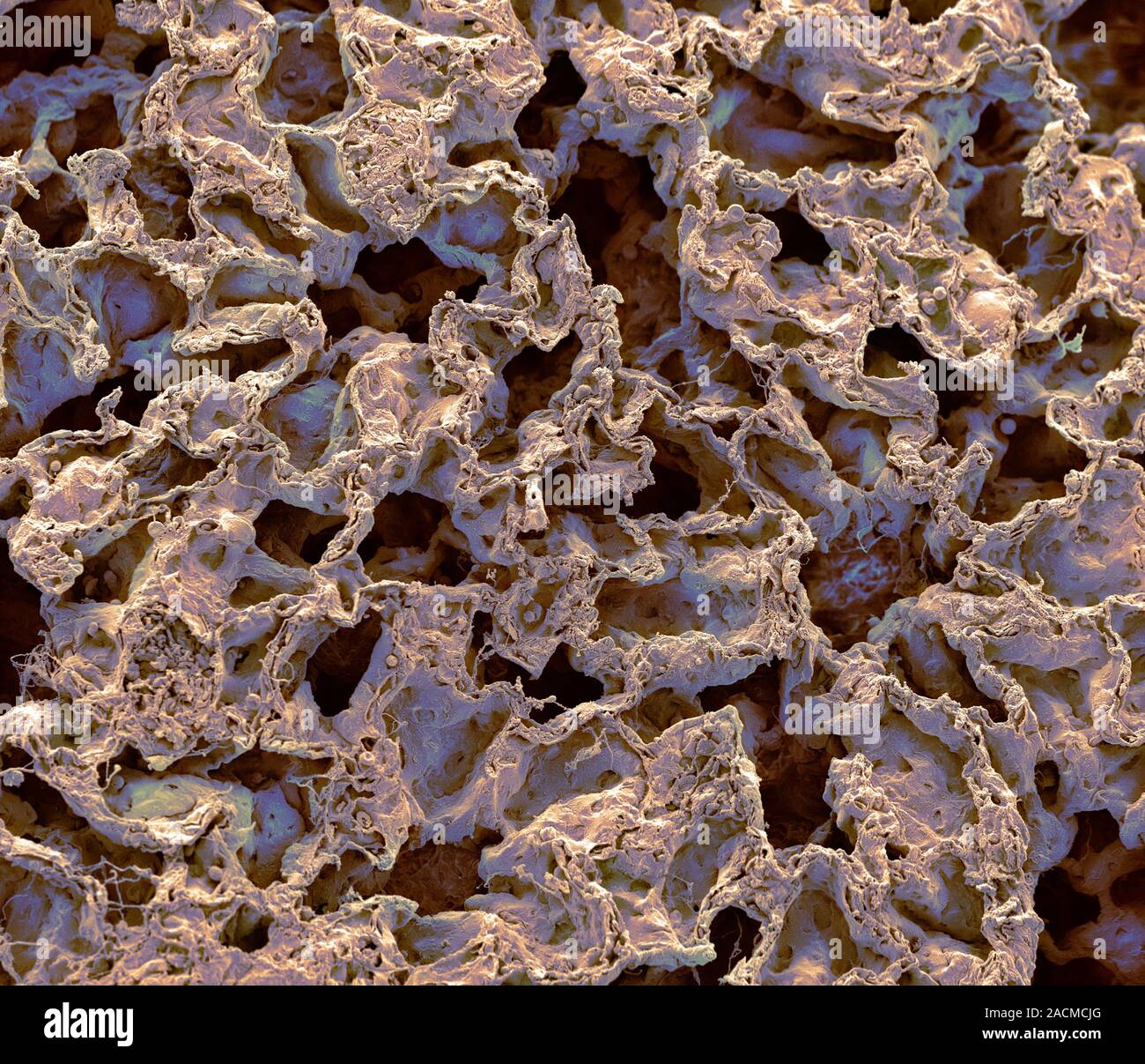 Lung tissue. Coloured scanning electron micrograph (SEM) of a section ...