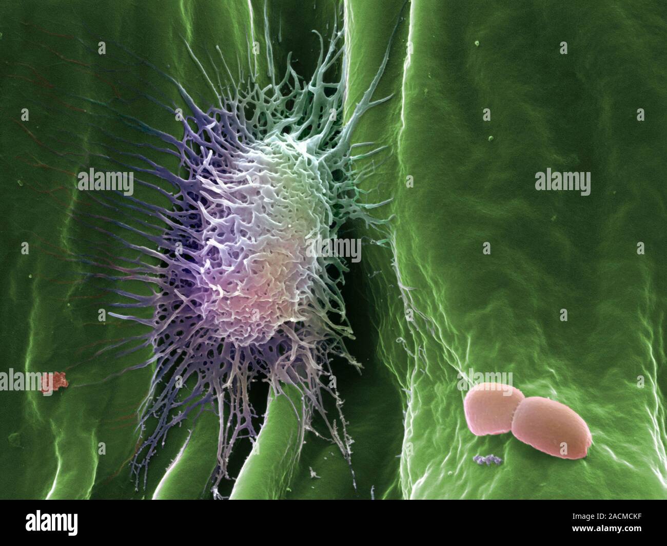 Infected apple tree leaf. Coloured scanning electron micrograph (SEM ...