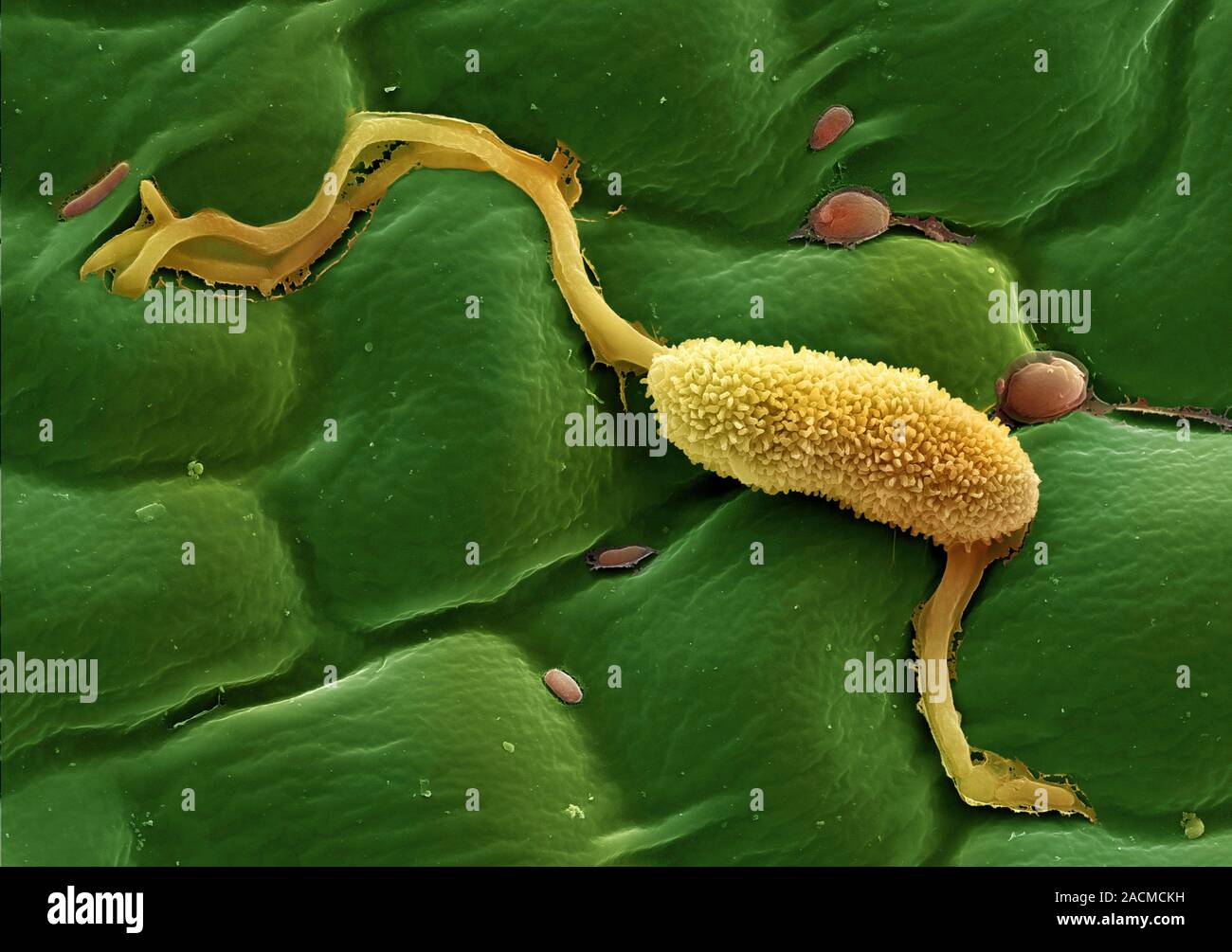 Infected apple tree leaf. Coloured scanning electron micrograph (SEM ...