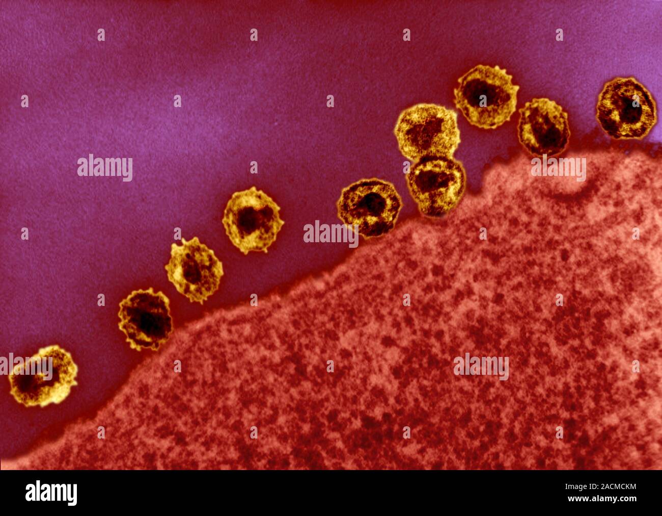 Cell infected with HIV. Coloured transmission electron micrograph (TEM ...