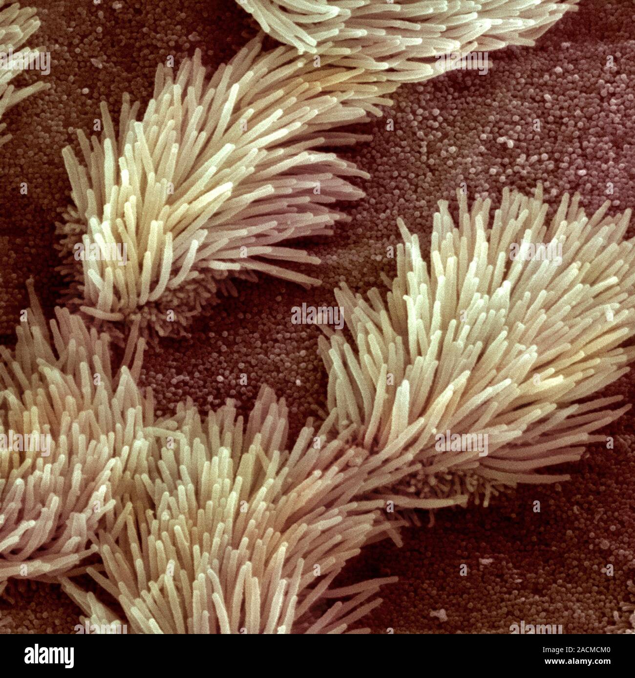 Bronchial epithelium. Coloured scanning electron micrograph (SEM ...