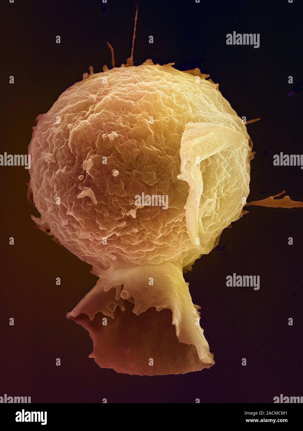 Lymphocyte. Coloured scanning electron micrograph (SEM) of a lymphocyte ...