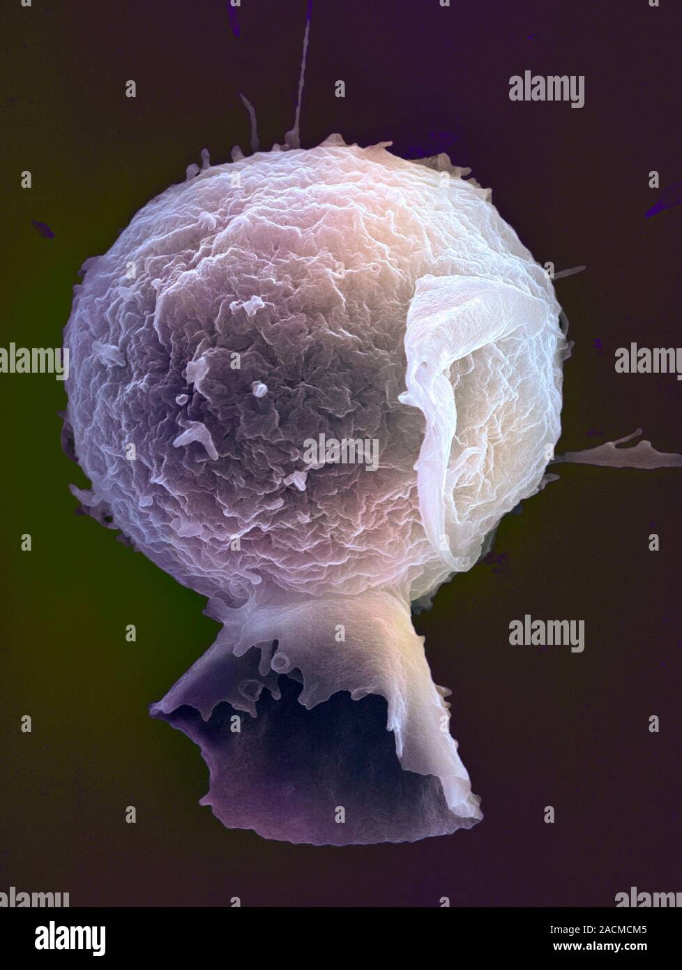 Lymphocyte. Coloured scanning electron micrograph (SEM) of a lymphocyte ...