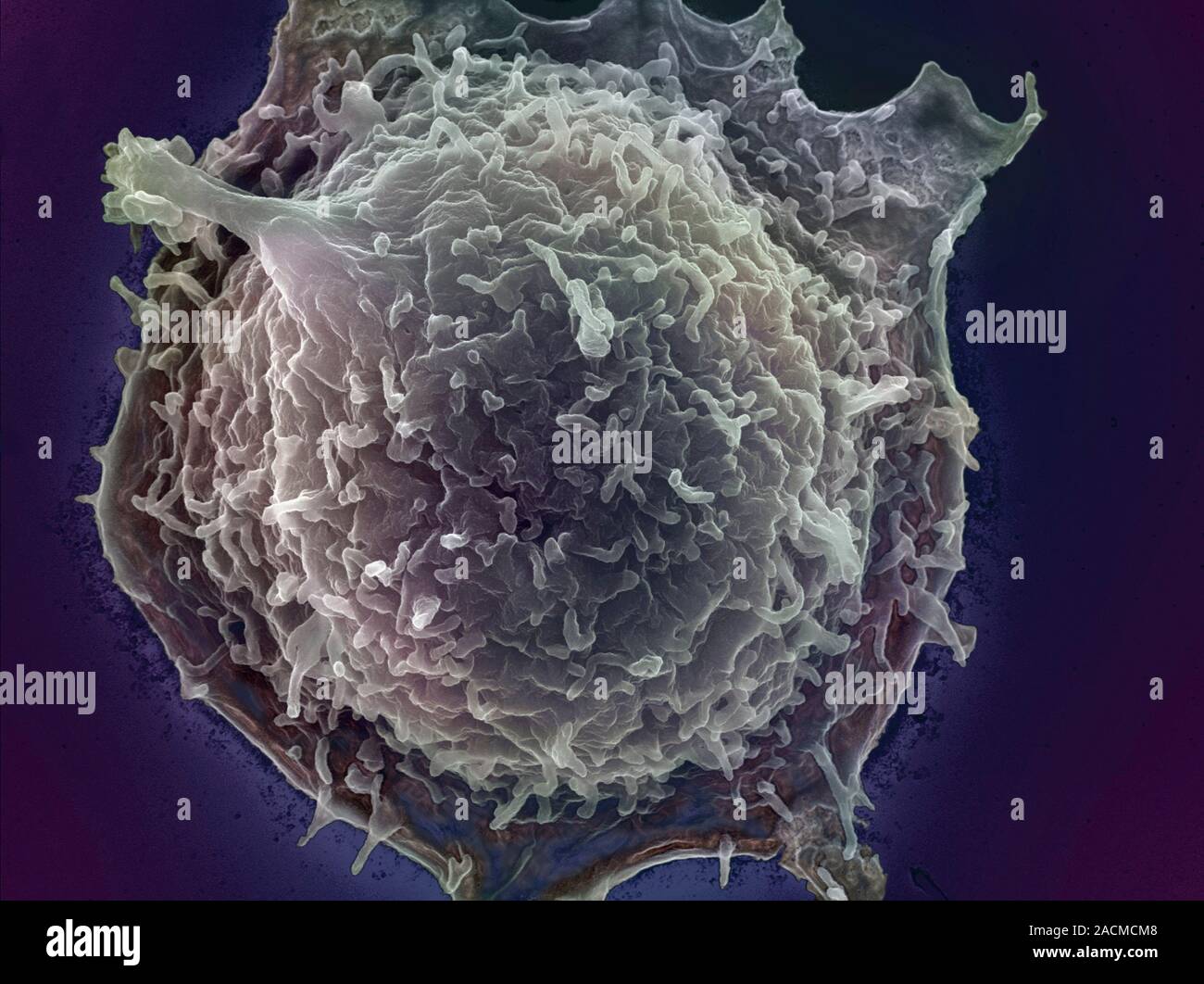 Lymphocyte. Coloured scanning electron micrograph (SEM) of a lymphocyte ...