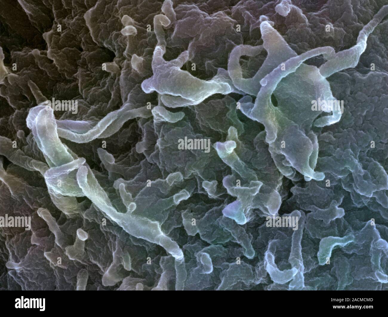 Lymphocyte. Coloured scanning electron micrograph (SEM) showing the ...
