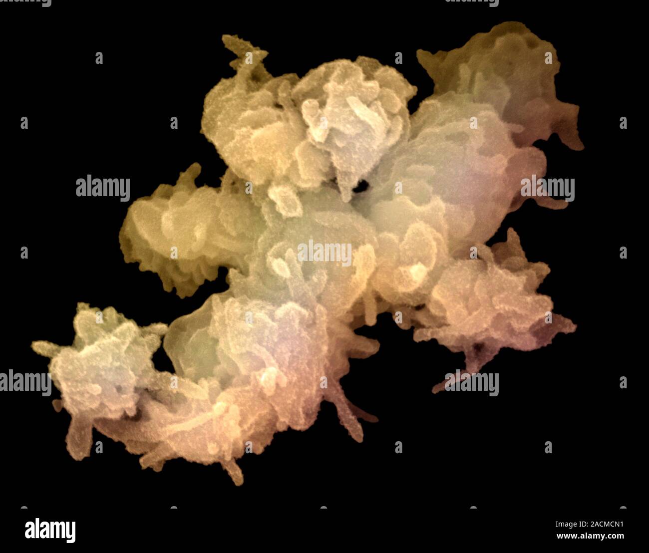 Platelets. Coloured scanning electron micrograph (SEM) of a clump of ...