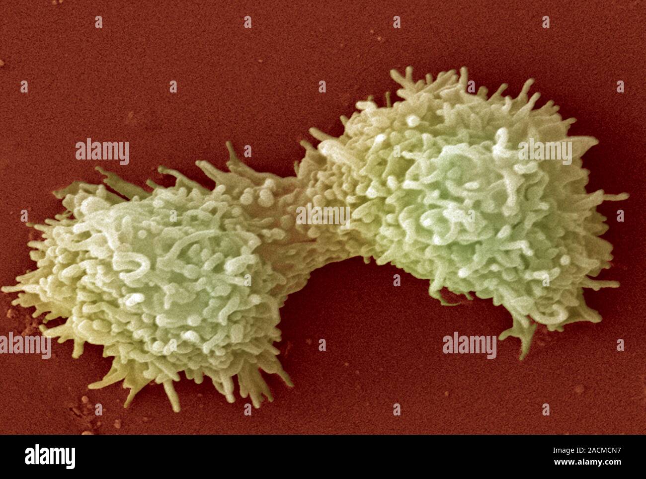 Amoebae. Coloured scanning electron micrograph (SEM) of two ...