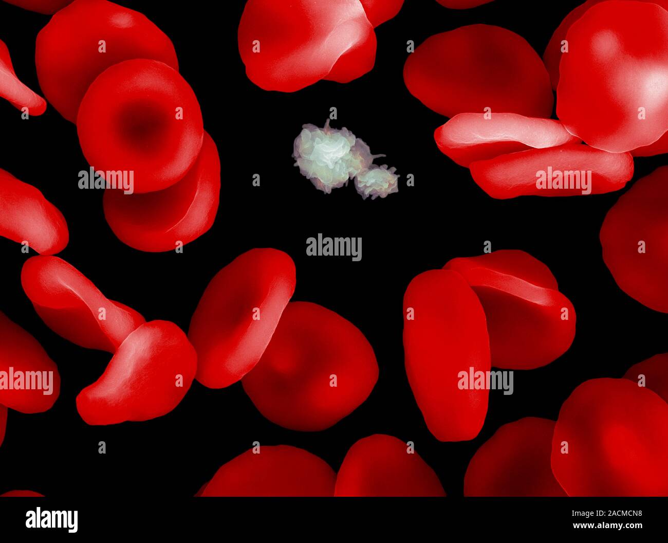 Red blood cells and platelets. Coloured scanning electron micrograph ...