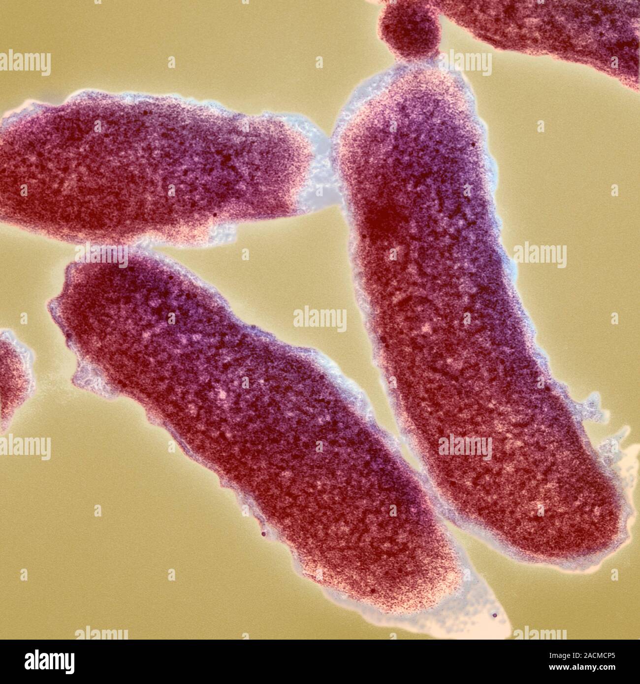 Cholera bacteria. Transmission electron micrograph (SEM) of Vibrio ...