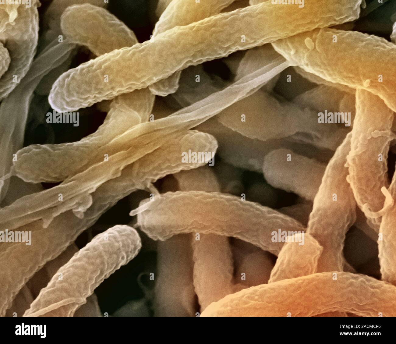Cholera bacteria. Coloured scanning electron micrograph (SEM) of Vibrio ...