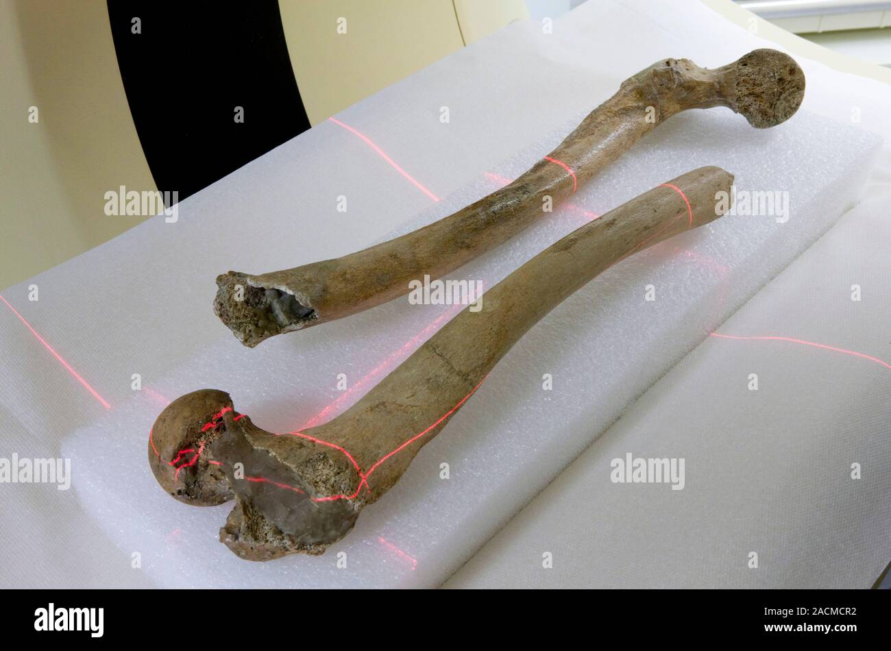 Scanning human fossil thigh bones. Medical scanner being used to scan ...