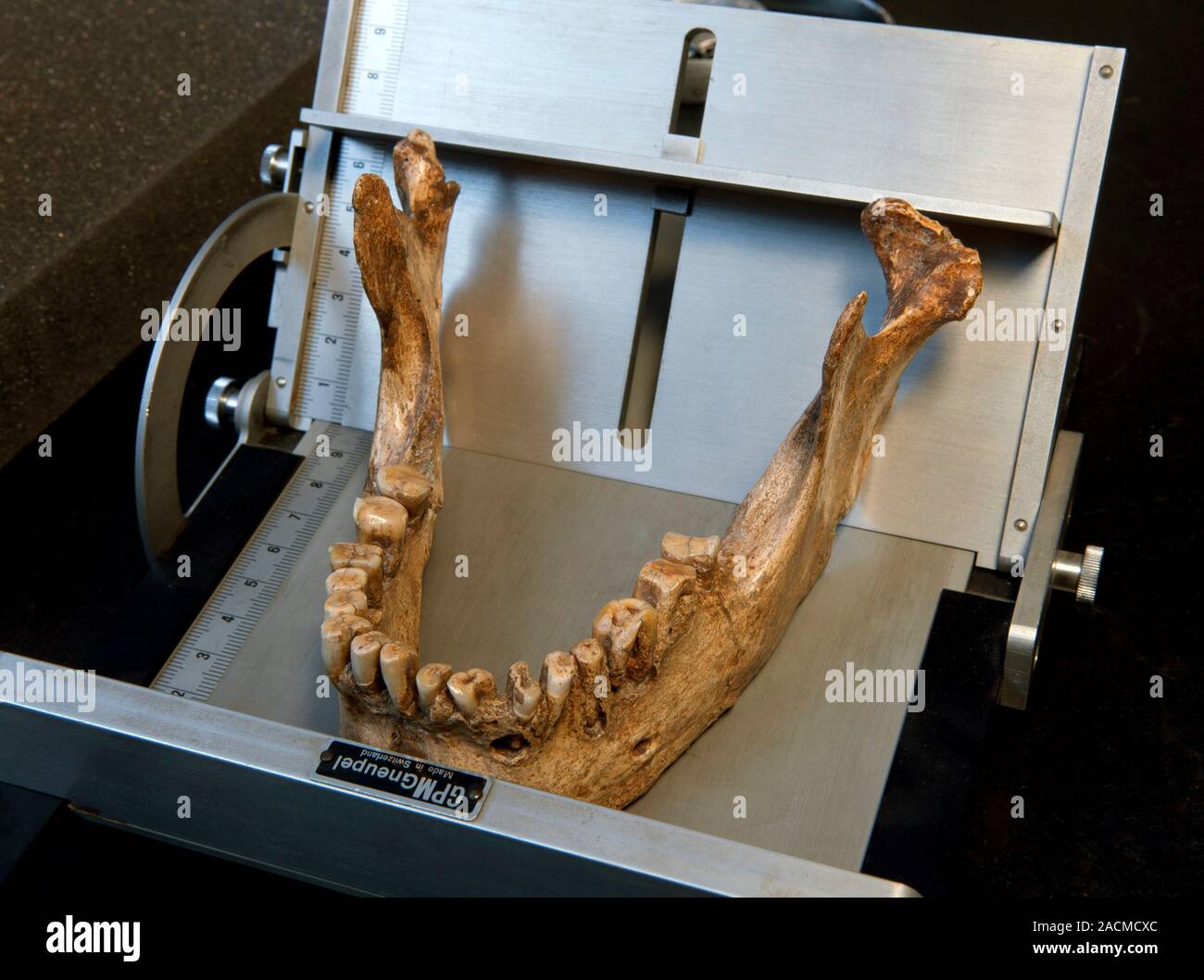 Neanderthal jaw bone. Cephalometer being used to make measurements on a ...