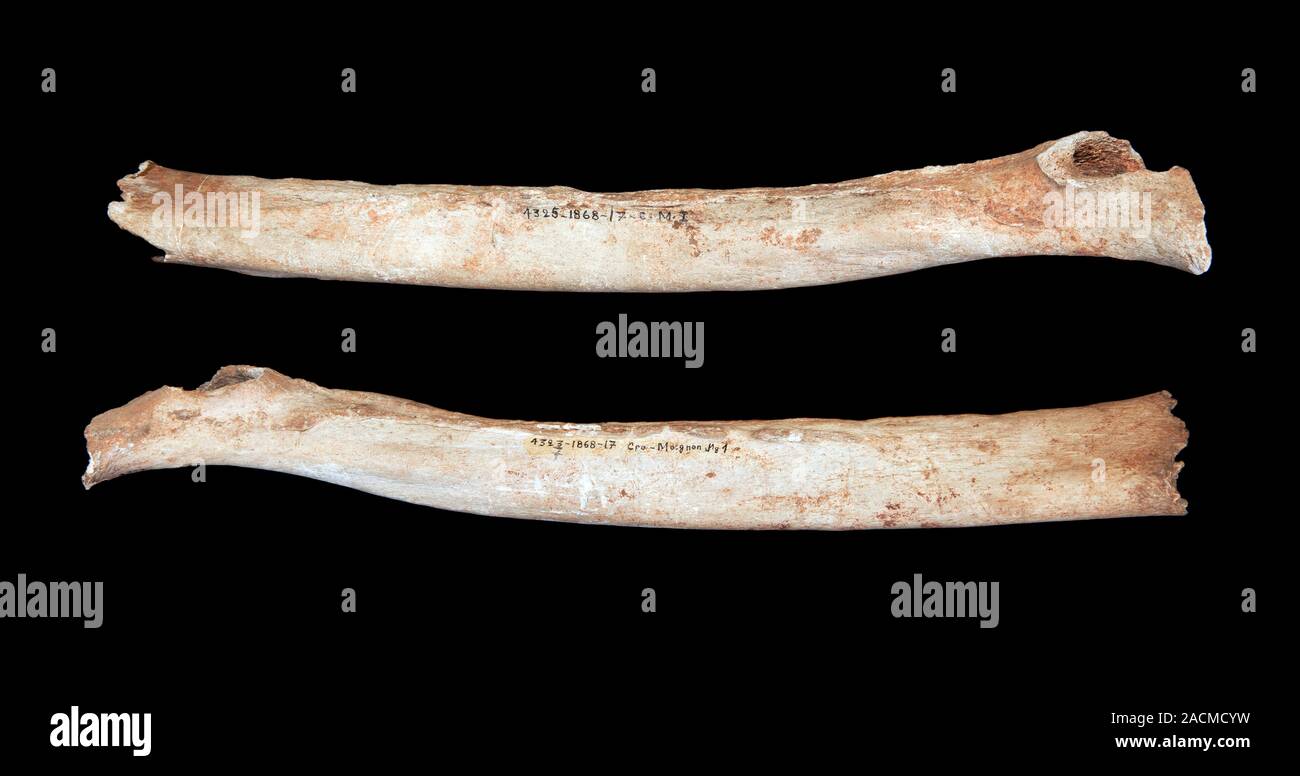 Cro-Magnon 1 fossil thigh bones. These are fragments, with only the ...