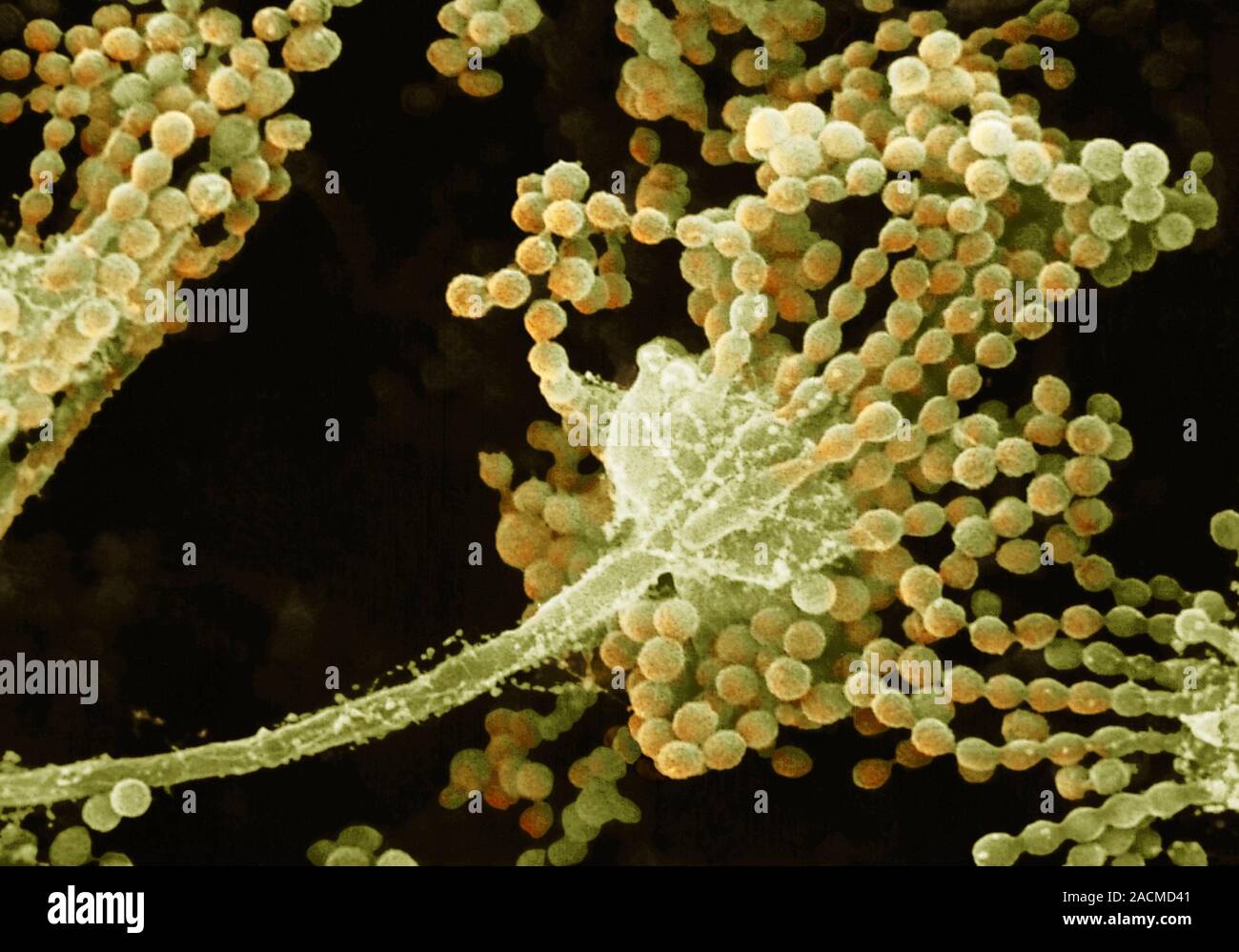 Aspergillus fungus. Coloured scanning electron micrograph (SEM) of the fruiting body ...