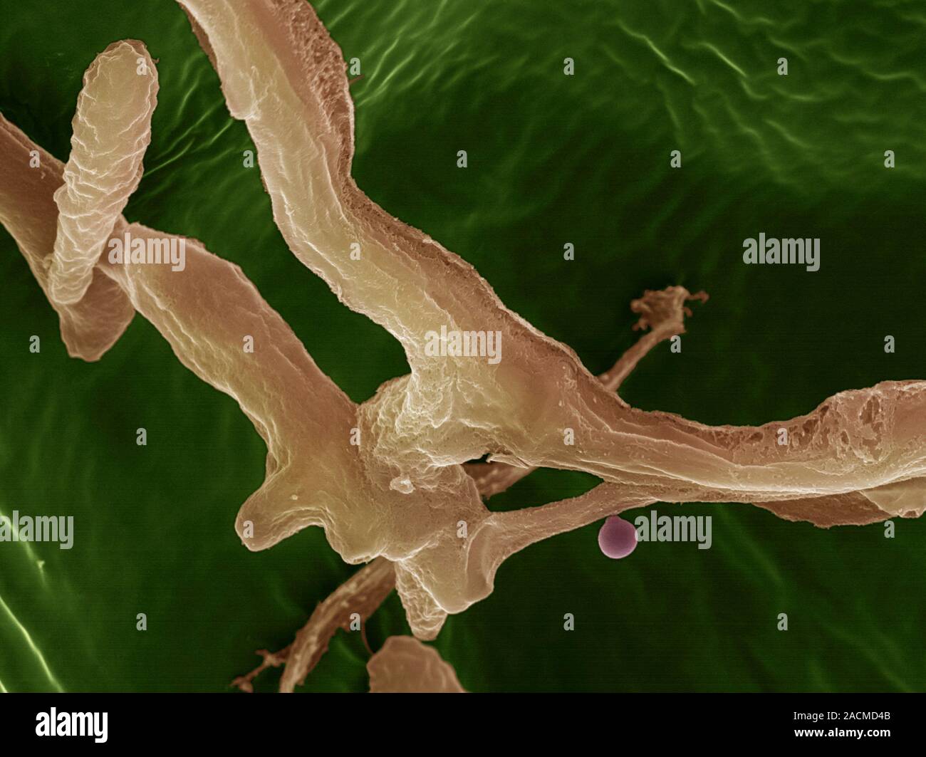 Apple tree fungus. Coloured scanning electron micrograph (SEM) of ...