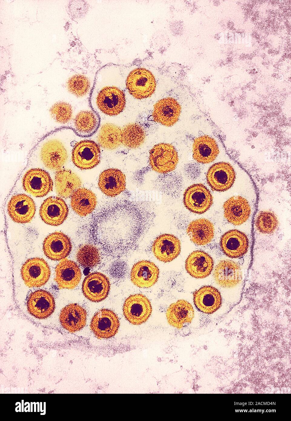 Herpes virus particles. Transmission electron micrograph (TEM) of a ...