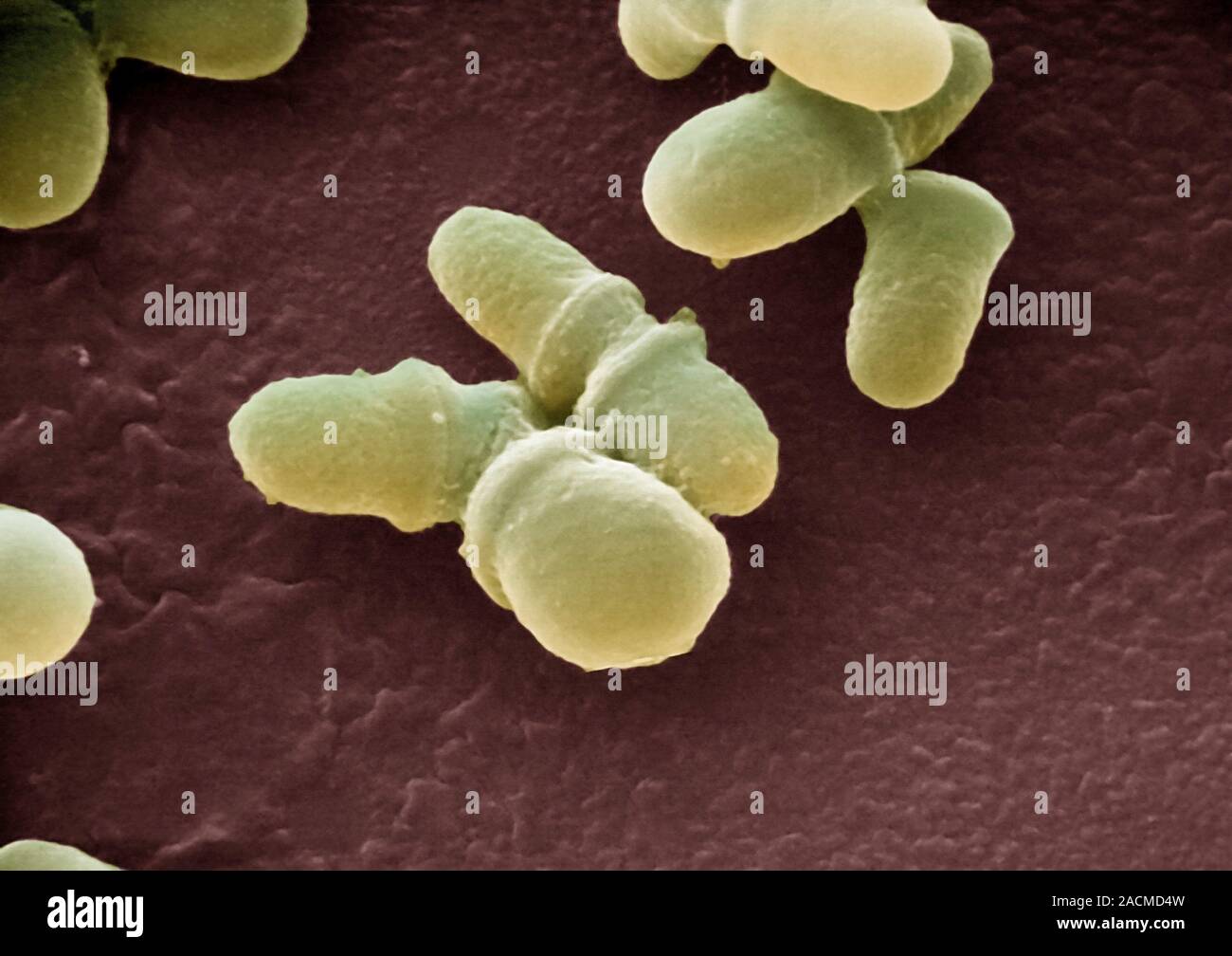 Malassezia skin fungus. Coloured scanning electron micrograph (SEM) of ...