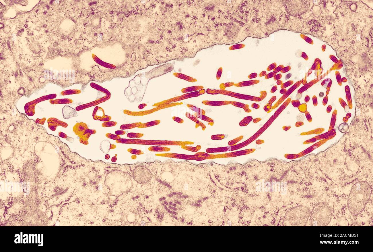 Marburg virus. Transmission electron micrograph (TEM) of multiple Marburg virus particles ...