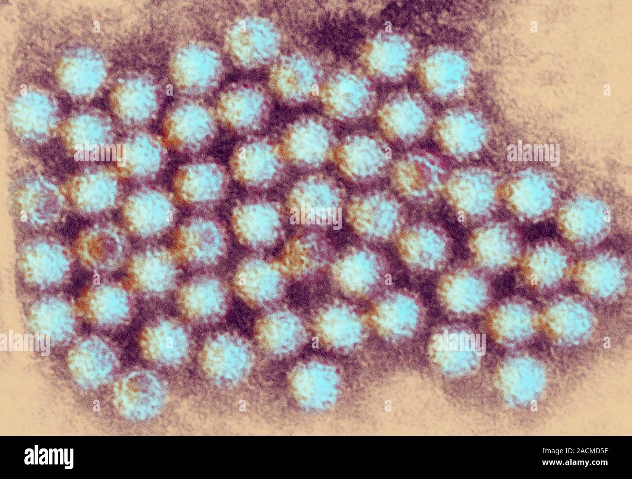Norovirus particles. Transmission electron micrograph (TEM) of ...