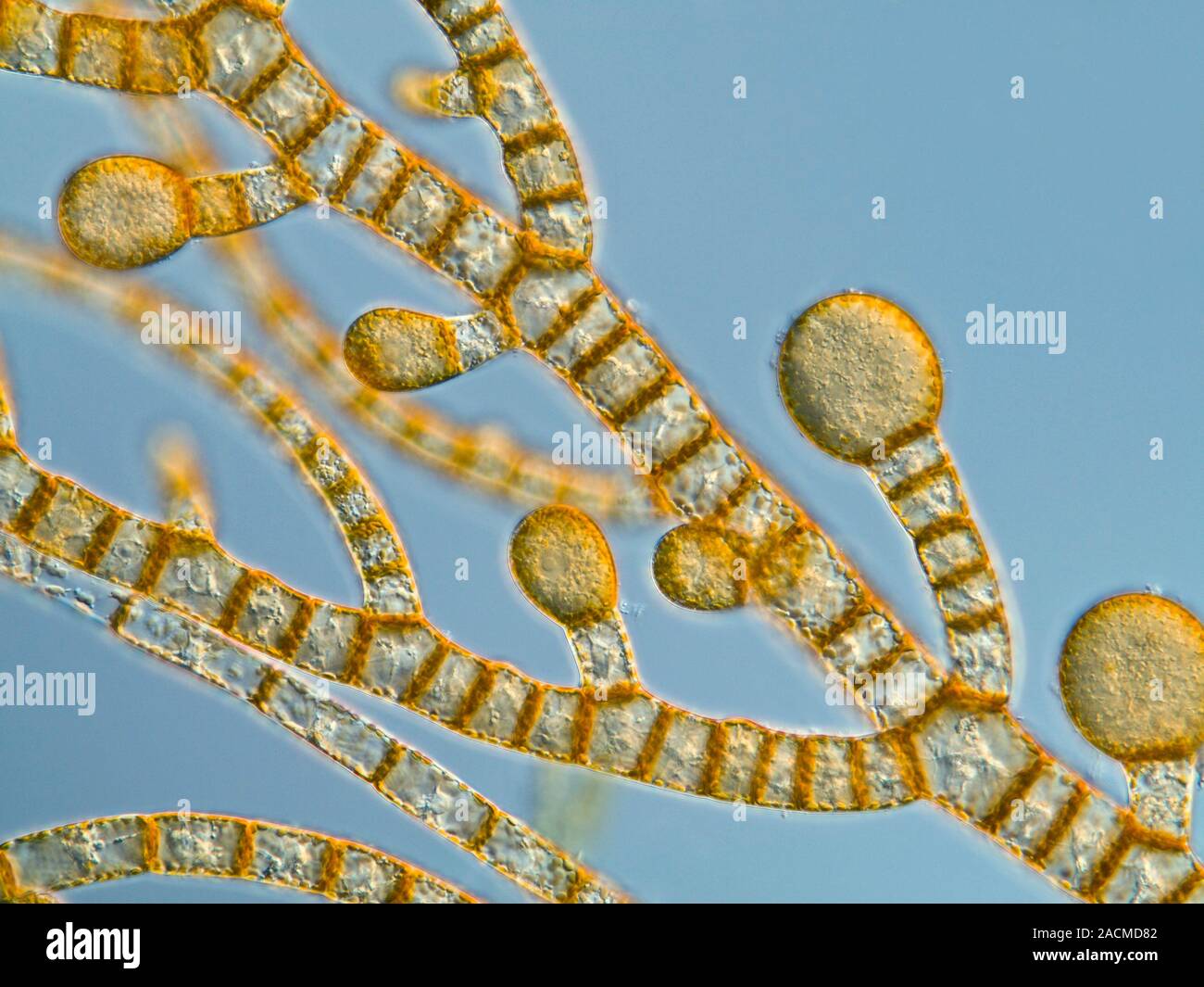 Brown algae. Differential interference contrast micrograph of the ...