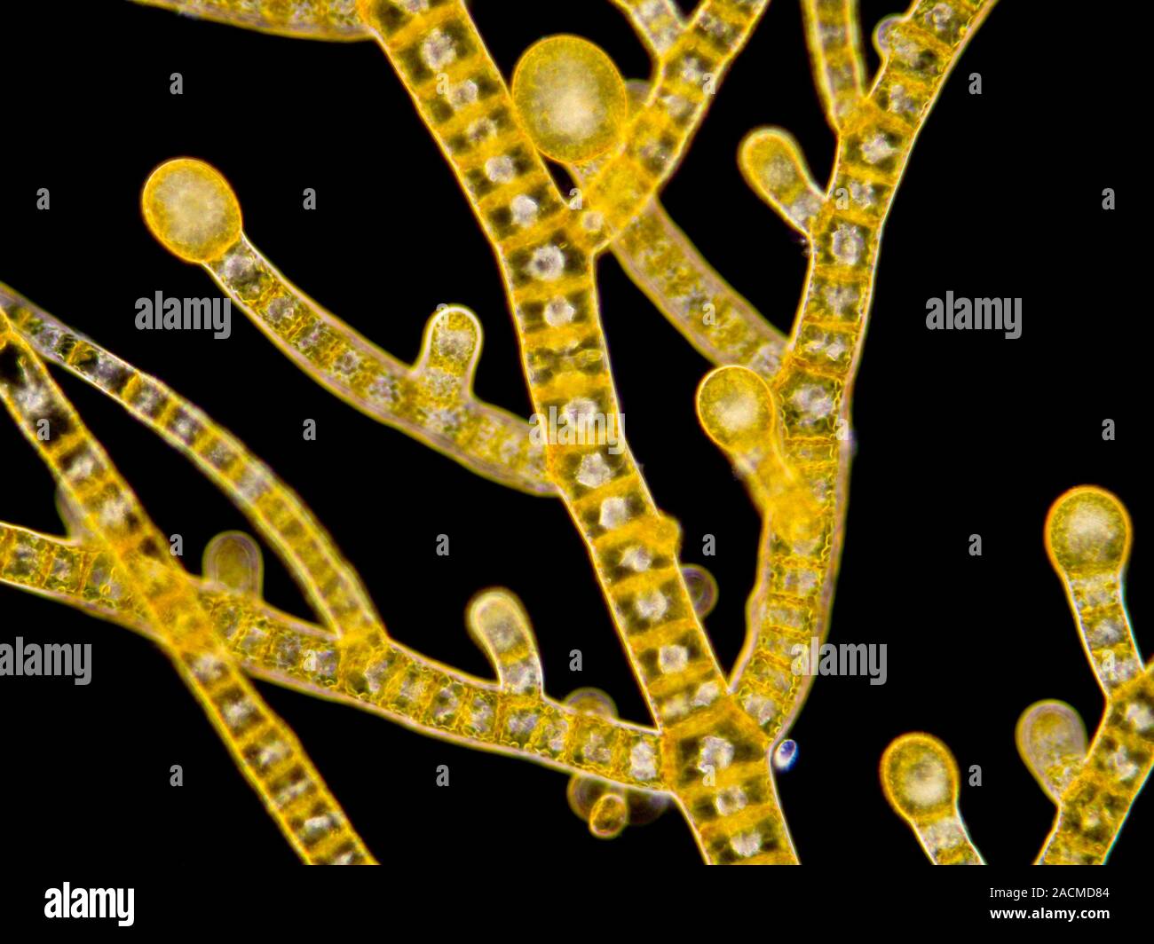 Brown algae. Darkfield contrast micrograph of the marine brown algae ...